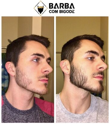 Barba com Bigode – Barba com Bigode